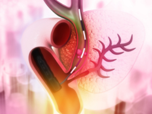 ERCP Endoscopy | GastroHub Clinic